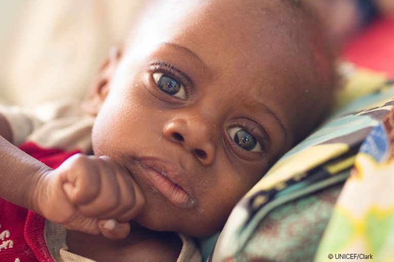 Inanición, lo que espera a 345 millones de personas en el mundo | SurySur